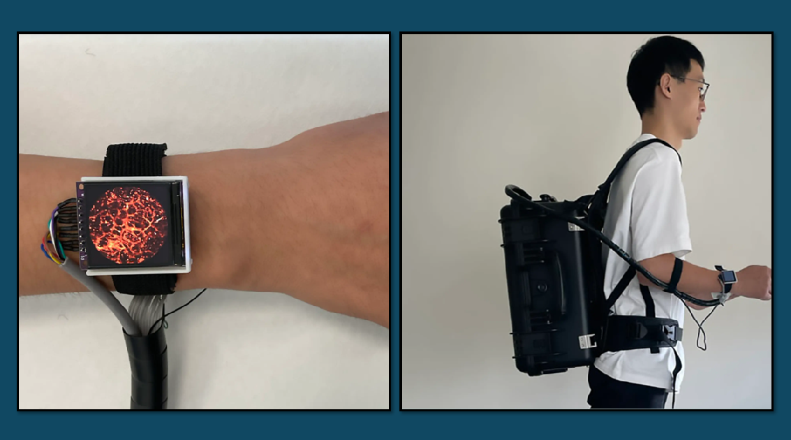 Primul ceas inteligent care realizează imagini ale vaselor de sânge în ...